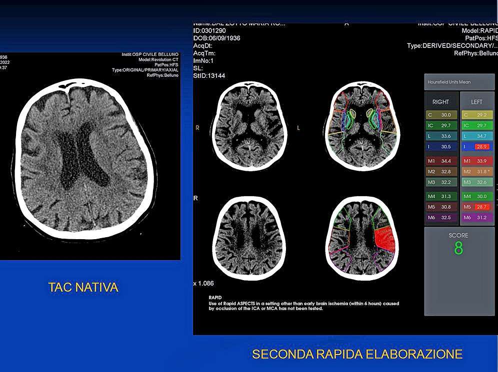 Da l’inteligenza artifiziala la prevenzion per l bòt - La Usc di Ladins ...